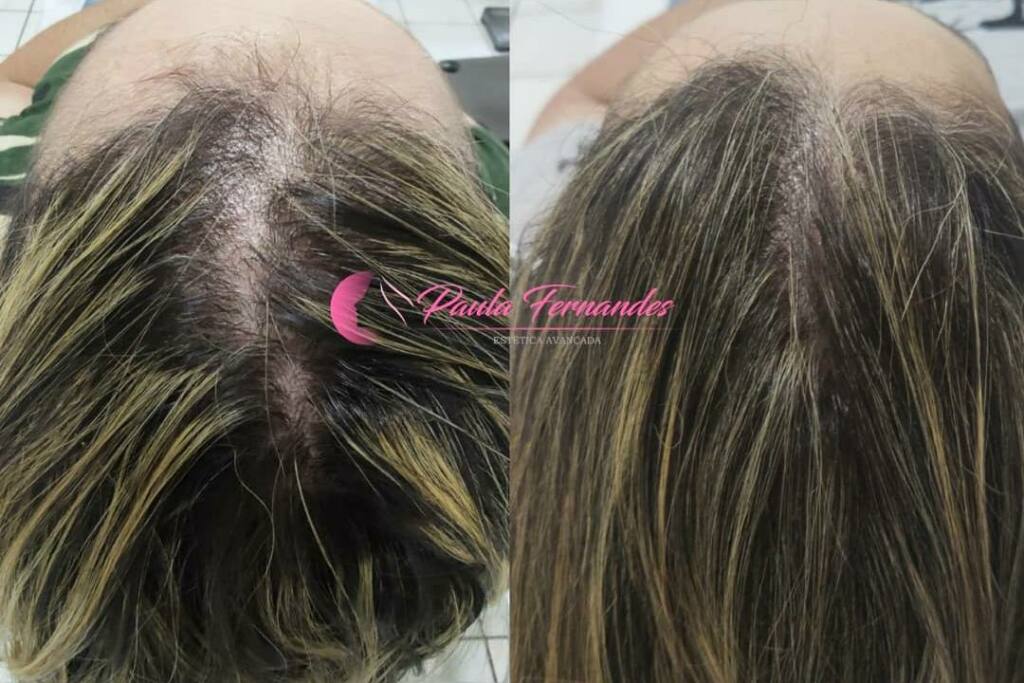 Estética Capilar – Paula Fernandes
